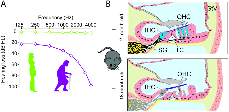 Genetic, molecular and biochemical basis of auditory ageing: lessons ...